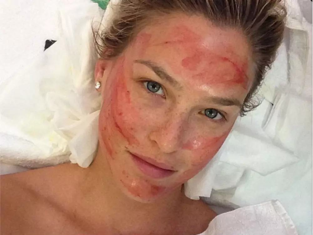 Nakuha ng Bar Refaeli ang Gold Facial... At 5 Iba Pang Kakaibang Celebrity Beauty Treatment 31205_2