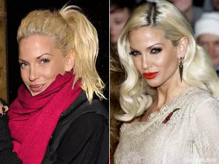 Sarah Harding - Sarah Harding merkt lipfillers ?in grutte flater? - Sarah Harding lip fillers UK